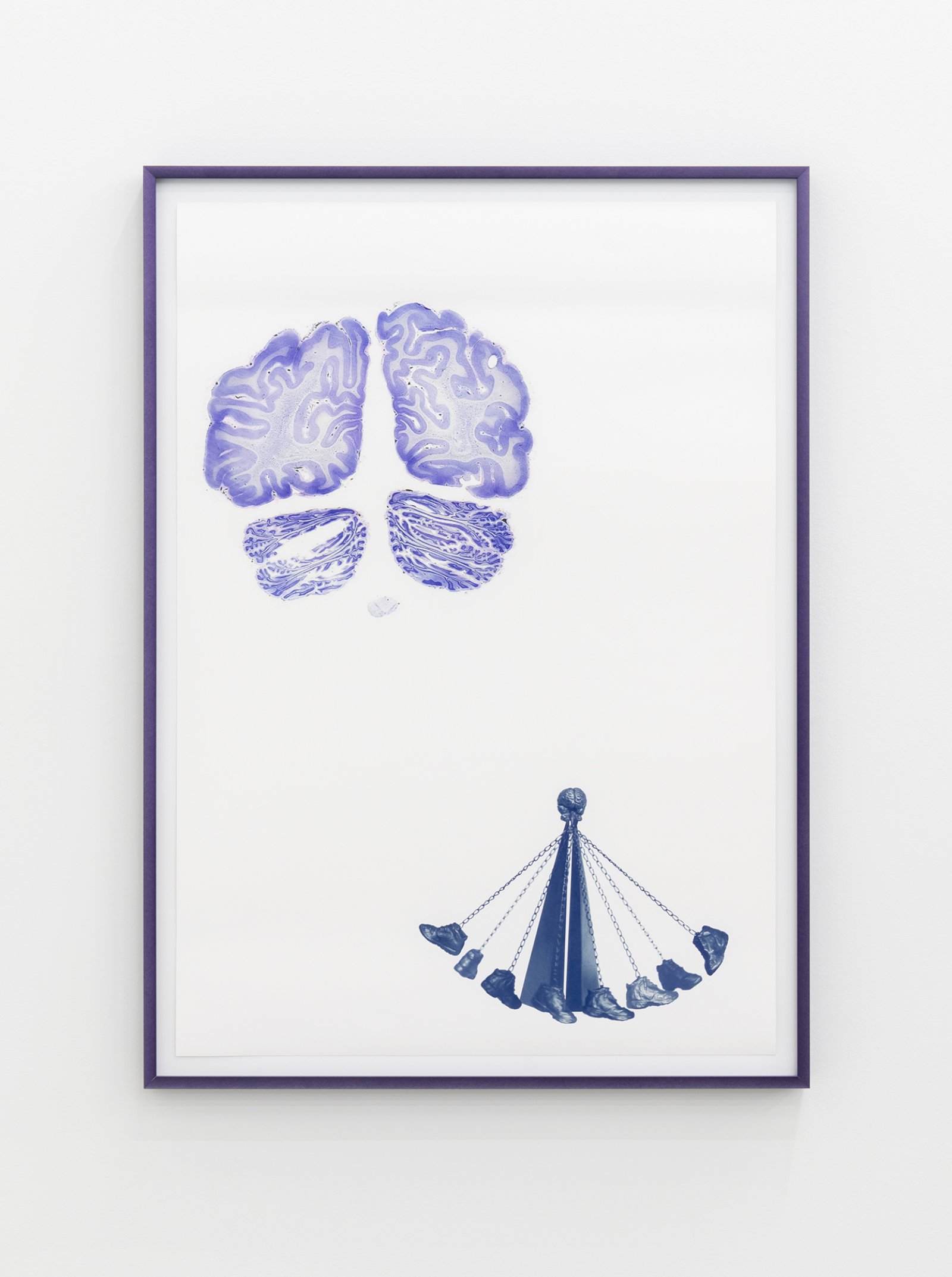 Judy Radul, End of the Autopsy (Brain and Boot), 2018 - Catriona Jeffries